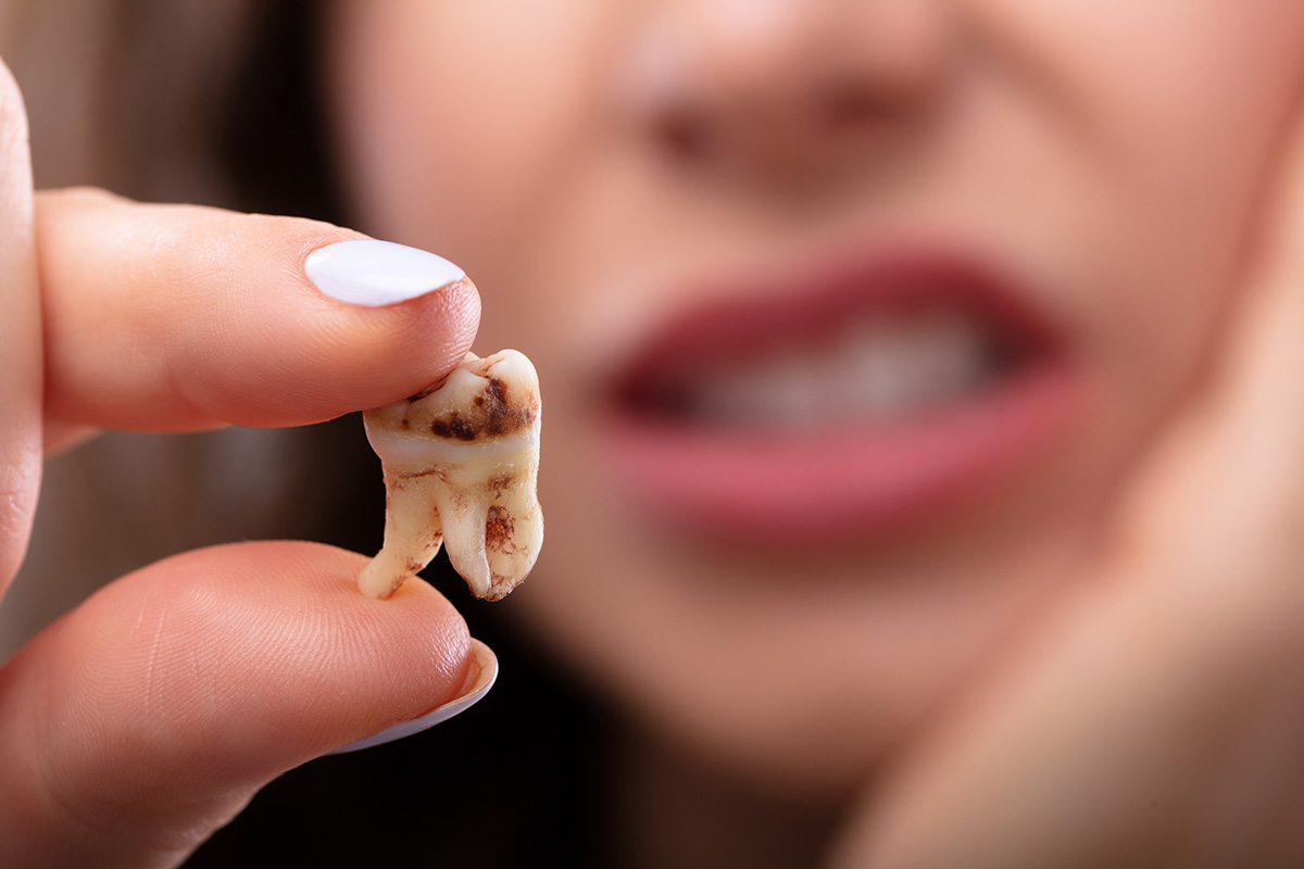 How Does Tooth Decay Develop Oral Health Lovett Dental Heights TX How Does Tooth Decay Develop Oral Health Lovett Dental Heights TX